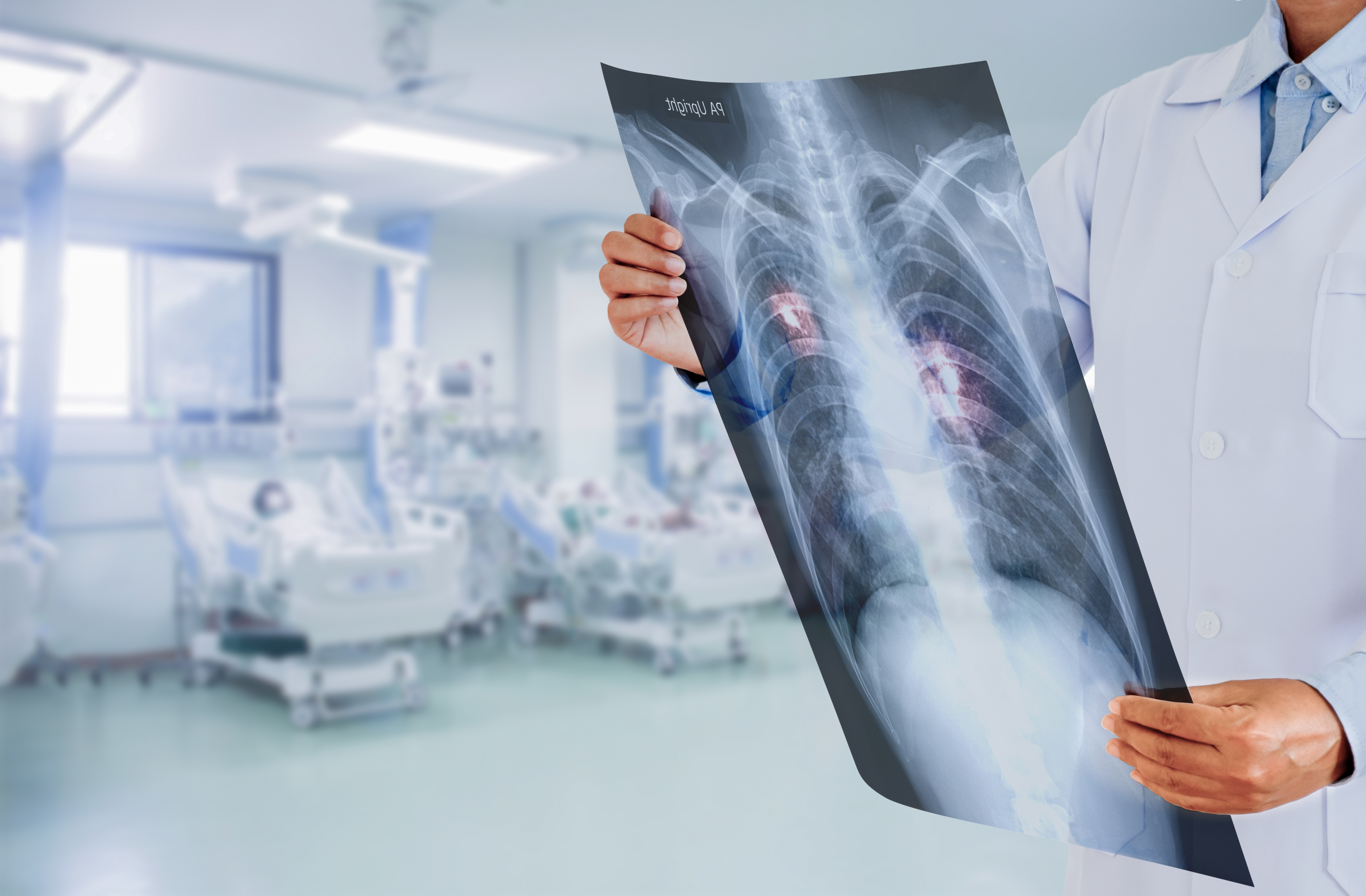 Onco Day: Focus on Thoracic Cancers | Swiss Medical Network